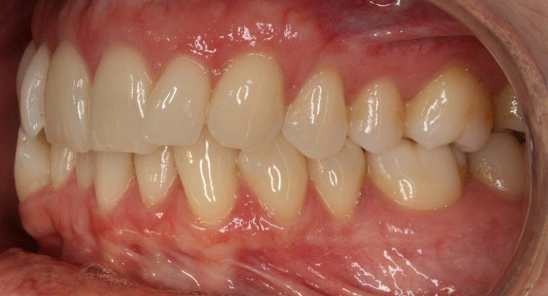 Our results - North Sydney Orthodontics
