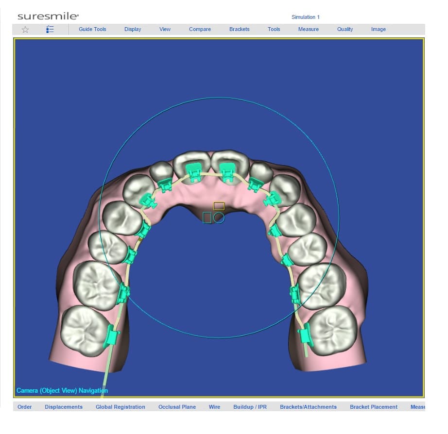 Sydney Invisible braces - North Sydney Orthodontics